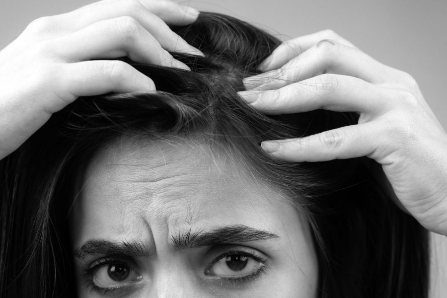 Causas de la caída del pelo: Todo lo que debes saber | ITC Medical